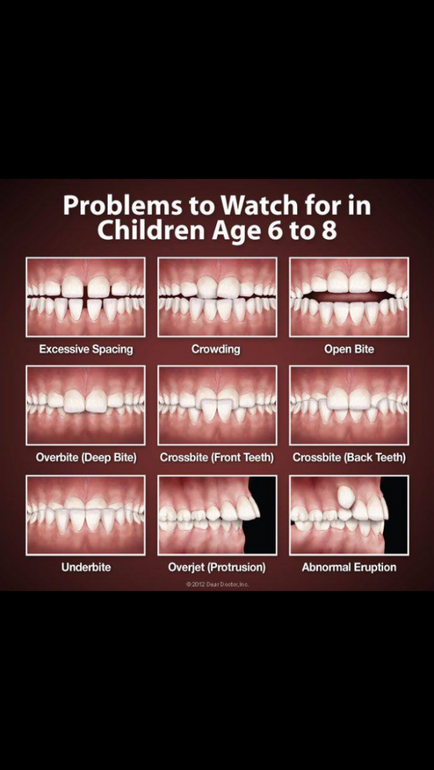 Wonky Teeth in Children | Dentist in Bucks - Dental Blog - The Village ...