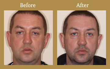 Homeoblock | Village Dental Health Centre | Gerrard's Cross, Bucks